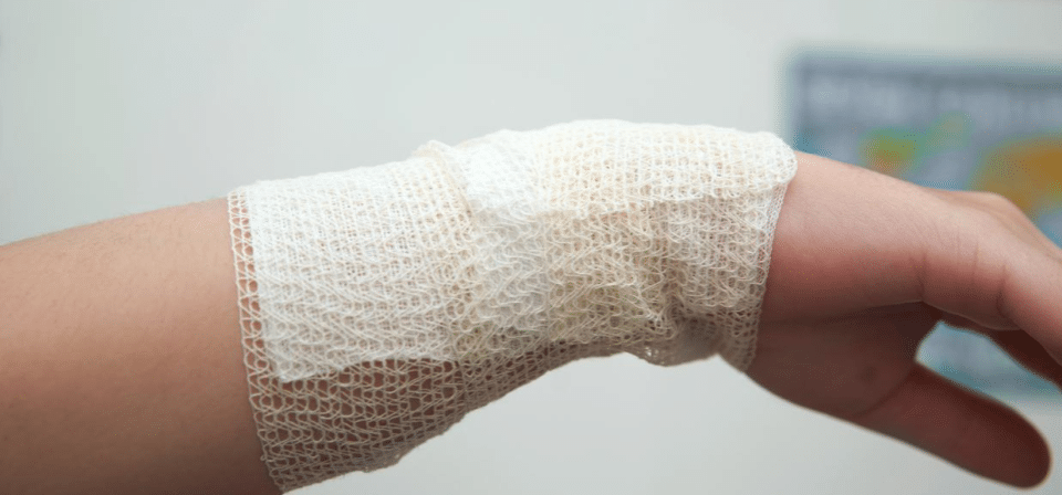 Identifying and Treating Different Types of Burns - Explainer